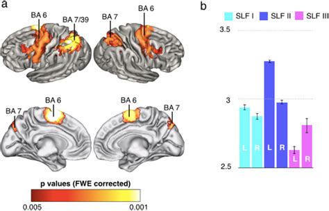 Functional Segregation And Integration Within Fronto Parietal Networks