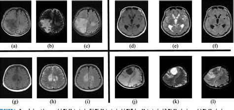 Figure 2 From A Modified Deep Convolutional Neural Network For Abnormal