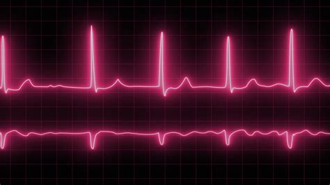 New Gene Identified For Treating Malignant Cardiac Arrhythmias Drug Target Review
