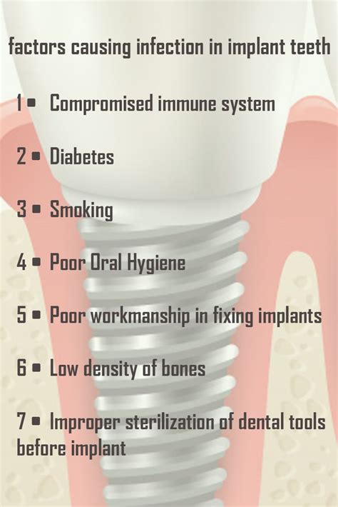 Dental Implant Surgery Infection At Nancy Hansen Blog
