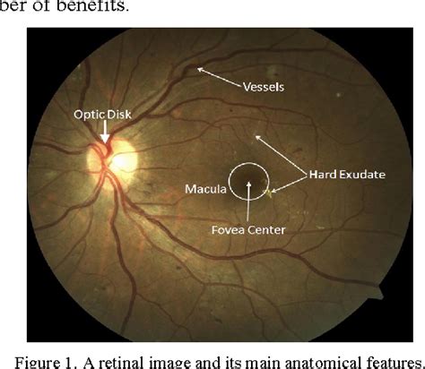 figure 1 from automatic and efficient detection of the fovea center in