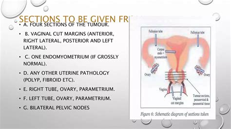 Histopath Grossing Of Uterus Cervix Andovary Pptx