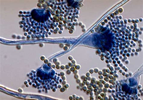 What Is Aspergillus Fumigatus