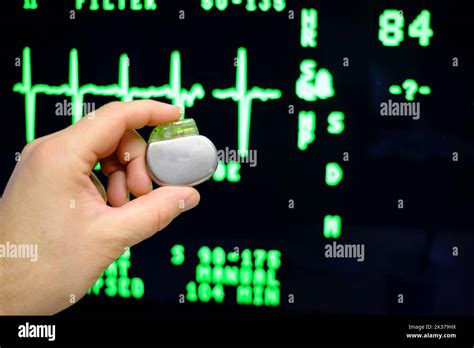 An Implantable Pacemaker Is Held In Front Of An ECG Monitor Stock Photo Alamy