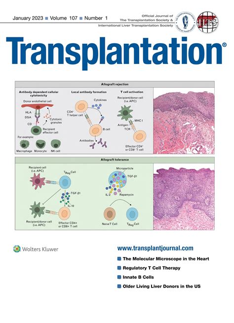 Re Imlifidase Generated Single Cleaved Igg Implications Fo