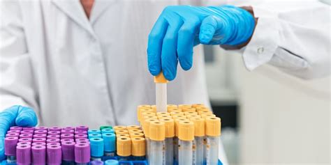 Efficiency Solutions For Small And Mid Size Testing Labs Lab Manager