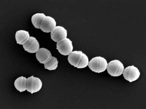 Record Number Hit By Flesh Eating Bacterium Streptococcal Toxic Shock Syndrome In Japan The