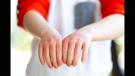 World Ozone Day Understanding Why It Is Important To Protect The Ozone Layer