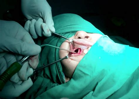 Terbaru 33 Gambar Penyakit Sinusitis