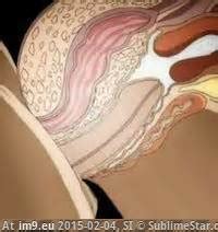 Pic 200x200 8308B Nemesis 0