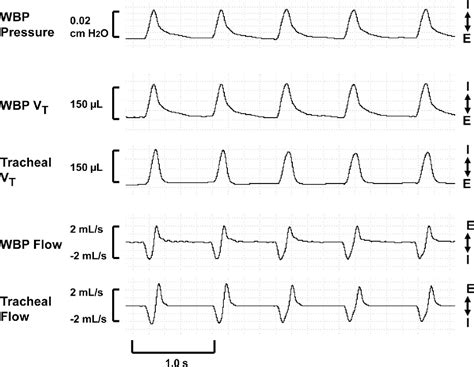 Figure 1 From Novel Whole Body Plethysmography System For The