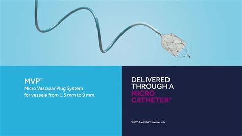 Overview Of The Medtronic Peripheral Embolization Portfolio Onyx™ Mvp