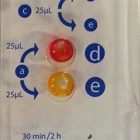 Pdf High Stringency Evaluation Of The Automated Bd Phoenix Cpo Detect And Rapidec Carba Np