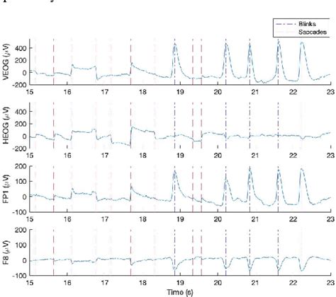 figure 1 from blink and saccade detection from forehead eeg semantic
