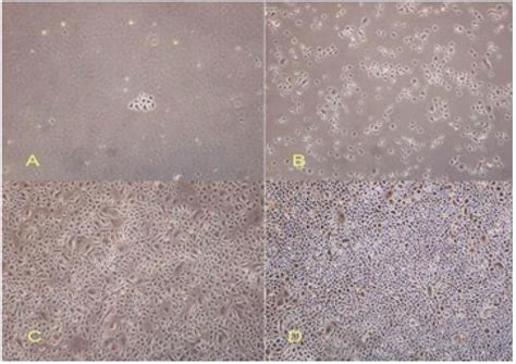 The Effect Of Seeding Density On Cell Growth Cells Were Seeded At