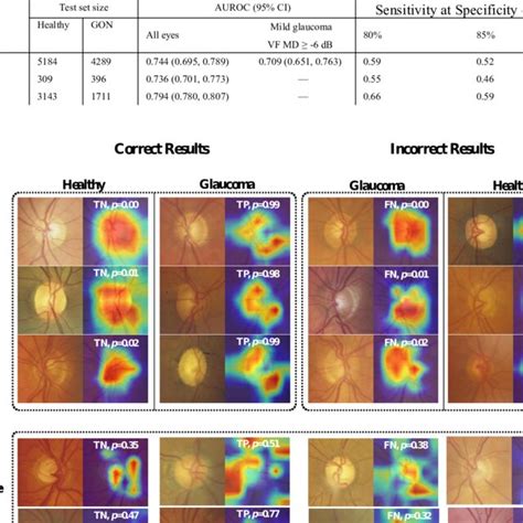 Resnet 50 6 Architecture Where Conv Represents A Convolution Layer Download Scientific
