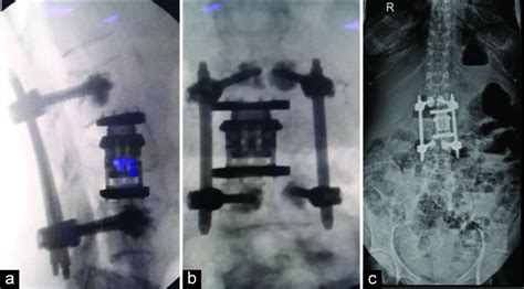 Surgical Neurology International