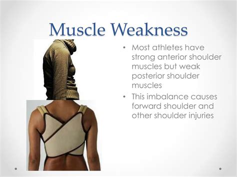 Ppt Ch 21 Shoulder Powerpoint Presentation Free Download Id1867518