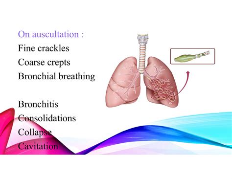 Bronchiectasis Ppt Pdf