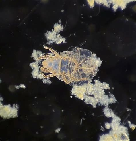 Diy Darkfield Filter Test 1 At 10x Objective 10x Eyepiece Youtube