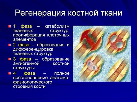 Переломы костей. Лечение переломов - презентация онлайн