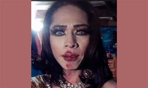 Agreden A Janeth Palacios Activista En Derechos De La Comunidad LGBT Durante Carnaval En La