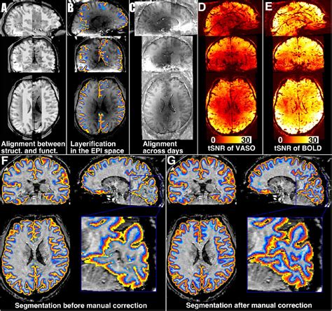 Fmri Brain Images