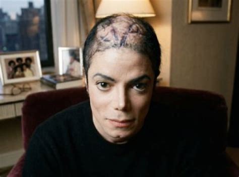 Did You Know Michael Jackson Was Basically Bald After He Died The
