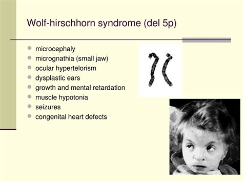 Ppt Cytogenetics And Integrated Laboratory Of Molecular Cytogenetics