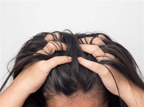 Top 5 Triggers Of Scalp Psoriasis Balmonds