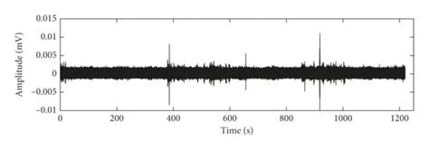 Original Microseismic Signals And Denoised Signals Collected In The Download Scientific Diagram