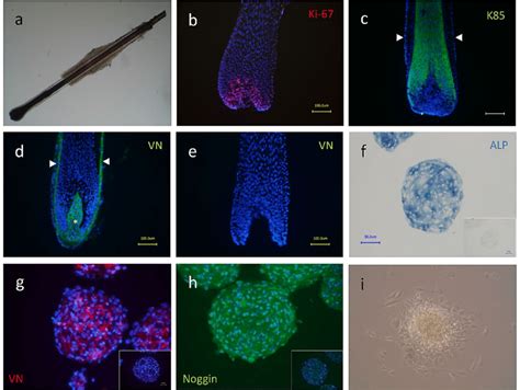Light Microscope Image Of A Plucked Scalp HS A Plucked HS Showing Download Scientific