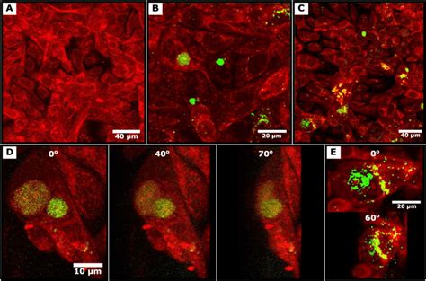 Analysis Of Nanoparticle Uptake By Ovarian Cancer Cells A To E Download Scientific Diagram