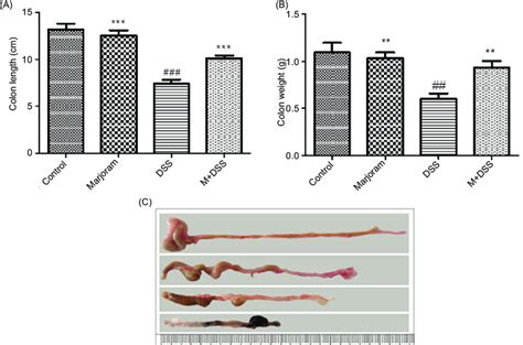A Colon Length B Colon Weight C Colon Macroscopic Analysis