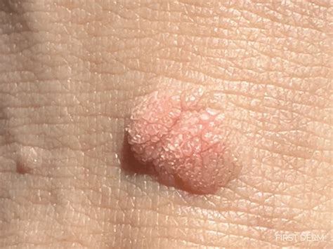 Skin Problems In Adults 20 Types Explained With Pictures And Causes