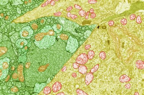 Retina Plexiform Layer 1 By Science Photo Library