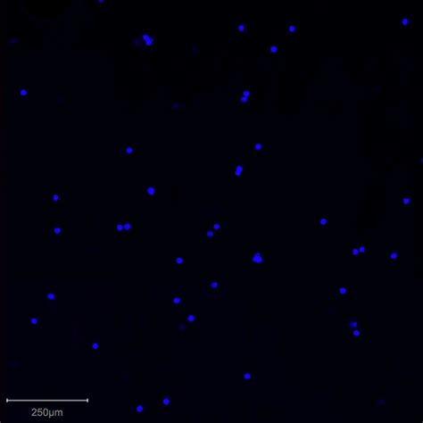 Nuclei Isolation From Human Cns Samples Using Nuc201 Isolation Kit From