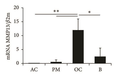 Detection Of Pedf Mrna And Protein In Adult Human Joint Tissues