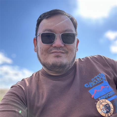 Perfect Smile Дээд доод 16 шүдэнд ШҮДНИЙ НҮҮРЭВЧ буюу ☆ Veneer хийсэний өмнөх дараах