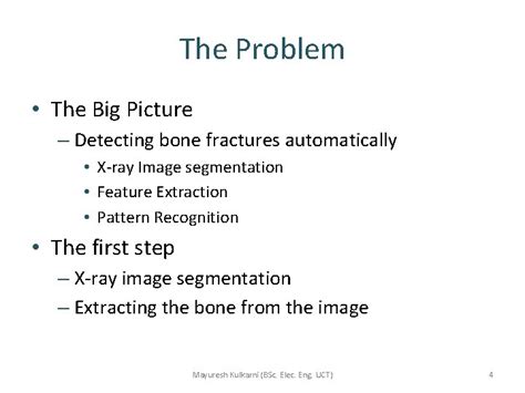 xray image segmentation using active shape models mayuresh
