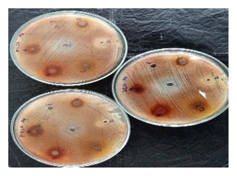 Aqueous A And Ethanolic B Extract Of A Muricata Against Mrsa With