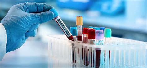 Project Implementation Caribbean Med Labs Foundation