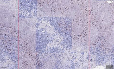 cellpose extension in qupath cannot get deconvolution and