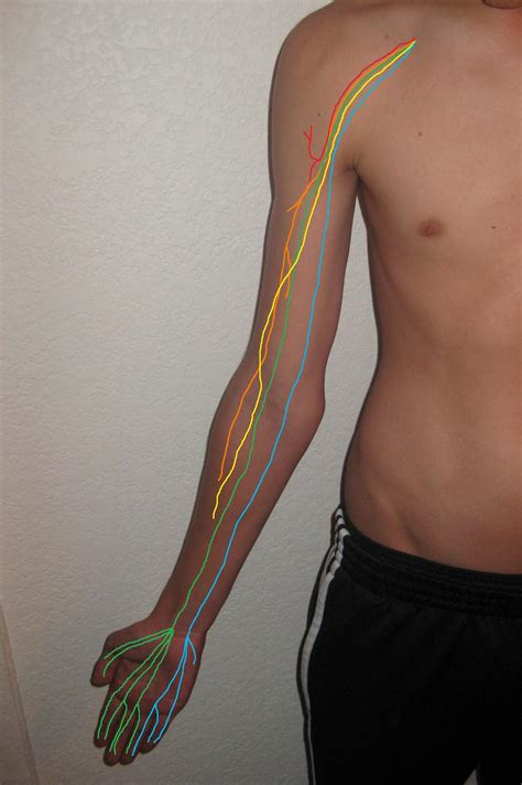 This Image Shows The Anterior View Of The Brachial Plexus Nerves On The Human Arm Axillary