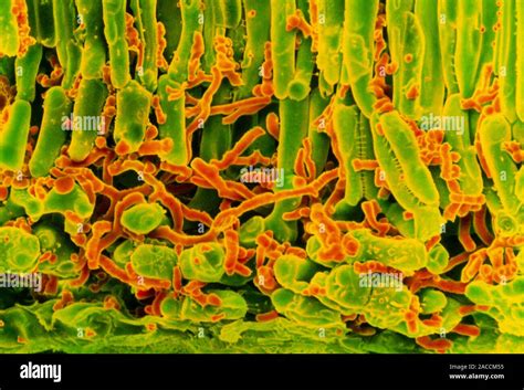 Rust Fungus Leaf Infection Coloured Scanning Electron Micrograph SEM Of A Section Through A