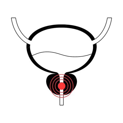 Premium Vector Prostatitis Inflammation Problem Premium Vector Prostatitis Inflammation Problem