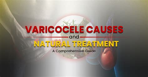 Varicocele Causes And Natural Treatment A Comprehensive Guide Dr Health