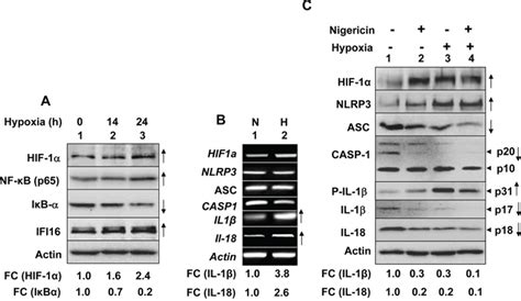 Hypoxia Primes Human Normal Prostate Epithelial Cells And Cancer Cell