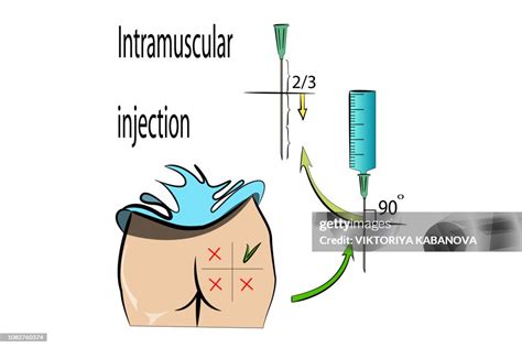 Rules For Intramuscular Injection High Res Vector Graphic Getty Images