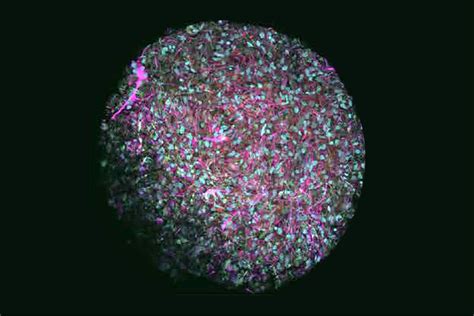 The Future Of Computing Includes Biology Ai Computers Powered By Human Brain Cells